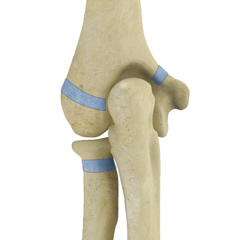 Little League Elbow Treatment Denver CO | Paediatric Elbow Injuries ...